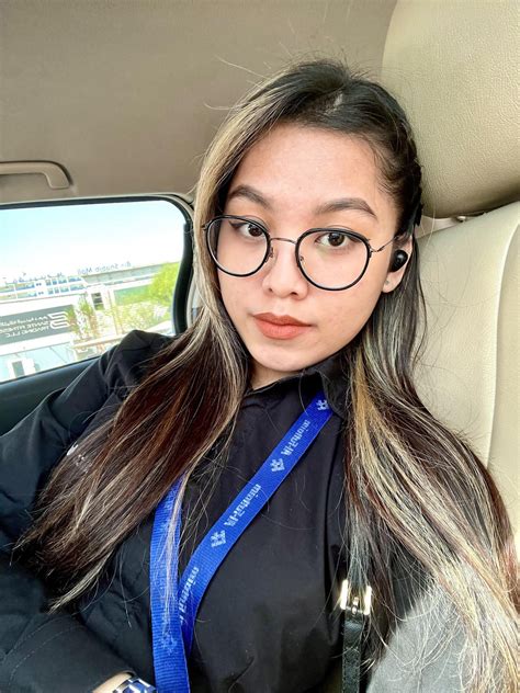 Almost A Year Off Accutane Raccutane