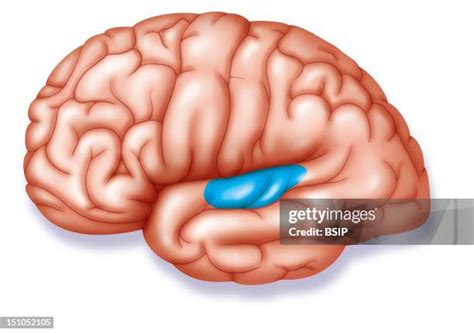 Primary Auditory Cortex