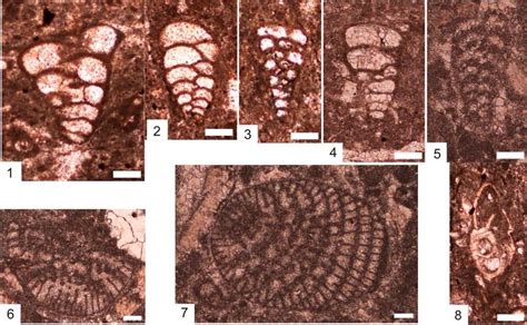 Microfossils Scale Bar 01 Mm100 Microns 1 5 Novalesia Producta