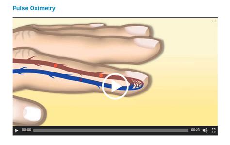 Openpediatrics Otwarte Zasoby