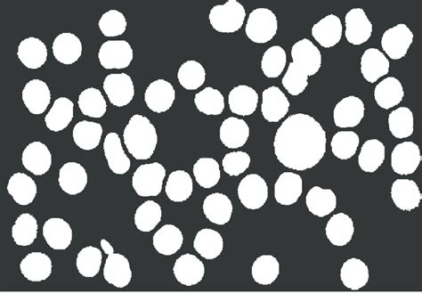 Noise Is Removed Using Pseudo Median Ilter Download Scientific Diagram