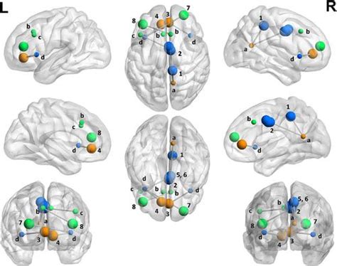 Specific Alterations Of Resting State Functional Connectivity In The Triple Network Related To