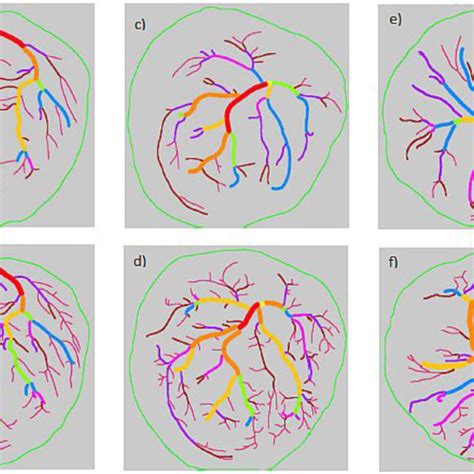 Illustrations Of The Performance Of Shape Matching Algorithm The Top Download Scientific