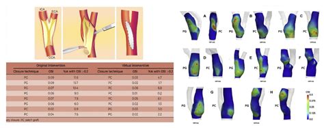 Selective Use Of Patch Graft In Carotid Endarterectomy And Evidences Of Restenosis