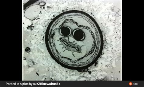 Cyanobacteria Looks Like Something Ive Seen Before R Oneyplays