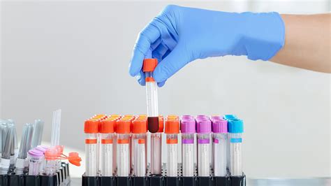 Assay Verification And Validation — Bio Rad Assay Verification And Validation — Bio Rad