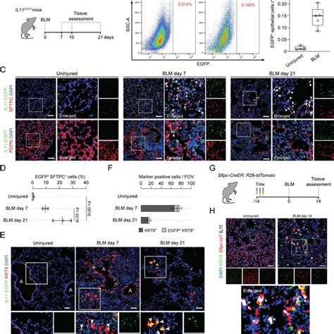 Il11 Signaling In At2 Cells Disrupts At2 To At1 Differentiation After