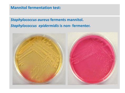 What Color Indicates A Positive Reaction For Mannitol Fermentation At