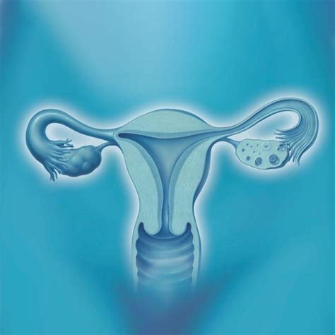 Comparison Of Intravenous Carbetocin And Intramuscular Oxytocin In