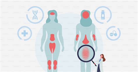 건선 개념입니다 의사 캐릭터는 인체의 영향을받는 부위를 보여줍니다 자가 면역 피부병 비늘 플라크 넓어지고 뒤틀린 혈관이 있는 라벨이 붙은 구조 만화 벡터