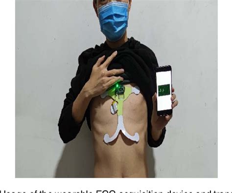 Figure 9 From Low Power Multi Lead Wearable Ecg System With Sensor Data Compression Semantic