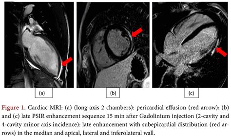 【contribution Of Cardiac Scientific Research Publishing Facebook