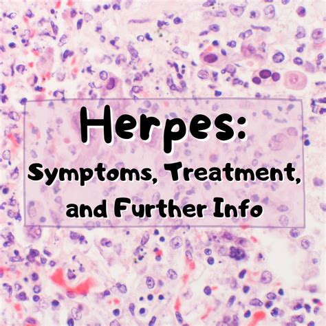 Hypertrophic Genital Herpes In An Hiv Infected Female 57 Off