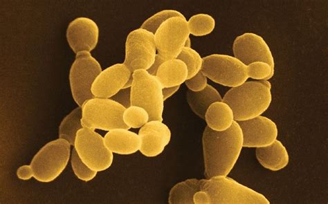 Yeast Expression Systems Creative Biomart