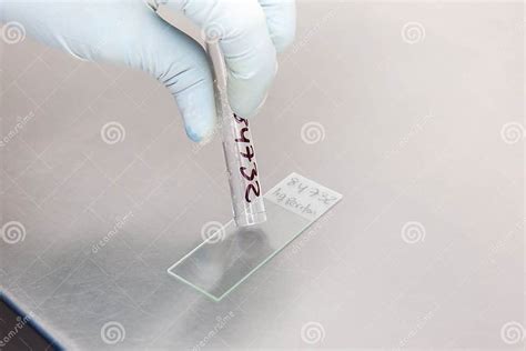 Scientist Preparing A Peritoneal Fluid Sample For Cytology Analysis In