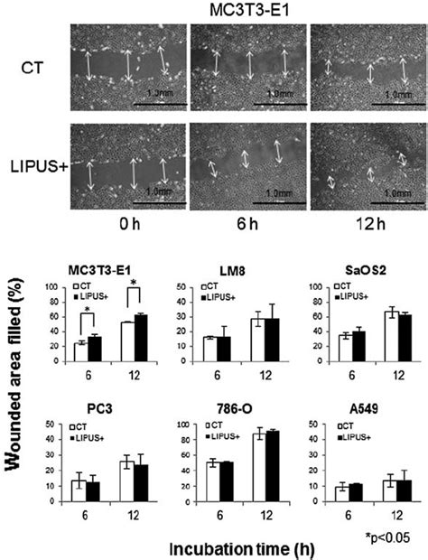 Lipus Stimulation Promoted Cell Migration Only In Mc3t3 E1 Each Cell