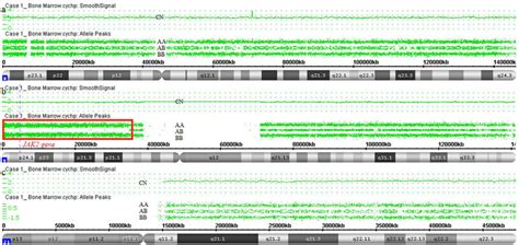 Genomic Alterations Detected By Snpa Affymetrix Cytoscan Hd Array