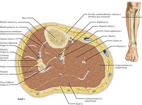 Leg And Forearm Fasciotomy Basicmedical Key