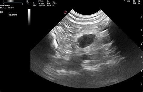 Adrenal Mass With Adrenalectomy In A 12 Year Old Fs Dsh Cat Members