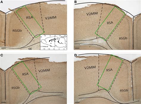 Frontiers Expression Of C Fos In The Rat Retrosplenial Cortex During Instrumental Re Learning
