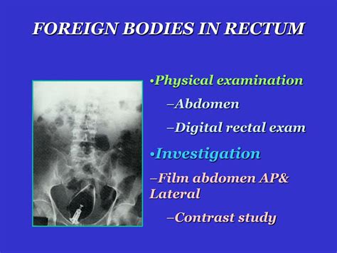 Ppt Colon And Rectum Injuries Powerpoint Presentation Free Download