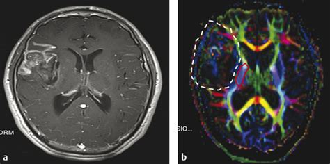 3 Going Beyond The Conventional Morphological Imaging An Overview Of Functional Imaging