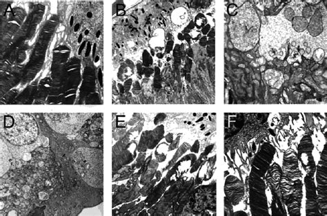 Electron Microscopy A Photoreceptor Outer Segments And Rpe In Download Scientific Diagram