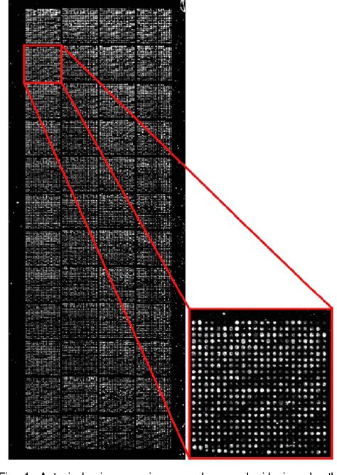 Figure 1 From Using The Maximum Between Class Variance For Automatic