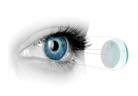 Dryeye Ocularhealth Optometry Amnioticmembrane Oct