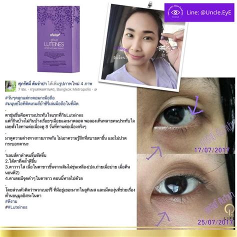 Uncleeye ผลลัพธ์สำหรับคนอยู่ติดจอ