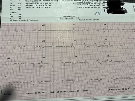 Incomplete Rbbb With Lad R Ekgs