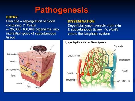 The Plague Y Pestis Eti Mezei Elodi Dielubanza