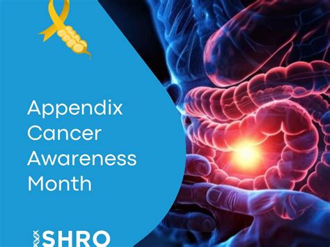 What You Need To Know About Appendix Cancer Sbarro Health Research Organization Oncodaily