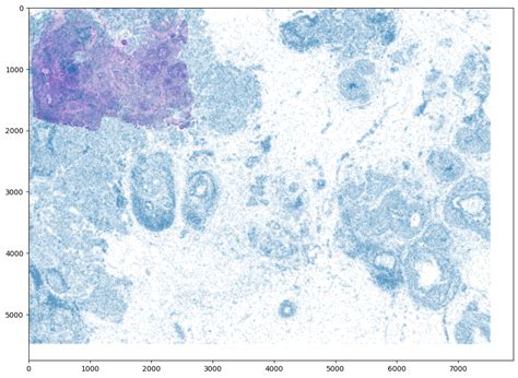 Aligning Single Cell Resolution Breast Cancer Spatial Transcriptomics