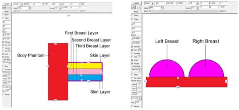 Exploring The Radioprotective Indium Iii Oxide Screens For