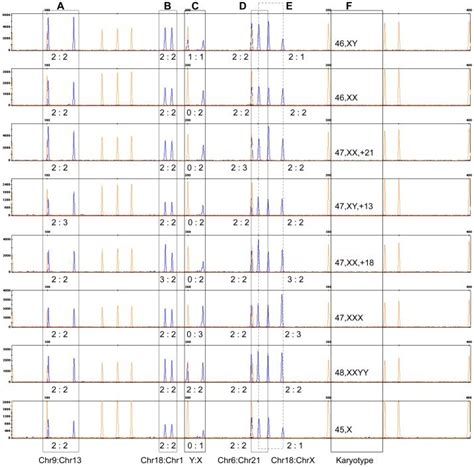 The Aneuploidies Of Chromosomes 13 18 And 21 Could Be Detected Using Download Scientific