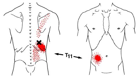 Mappa Trigger Point Clicca Qui E Scaricala Maniesperteit