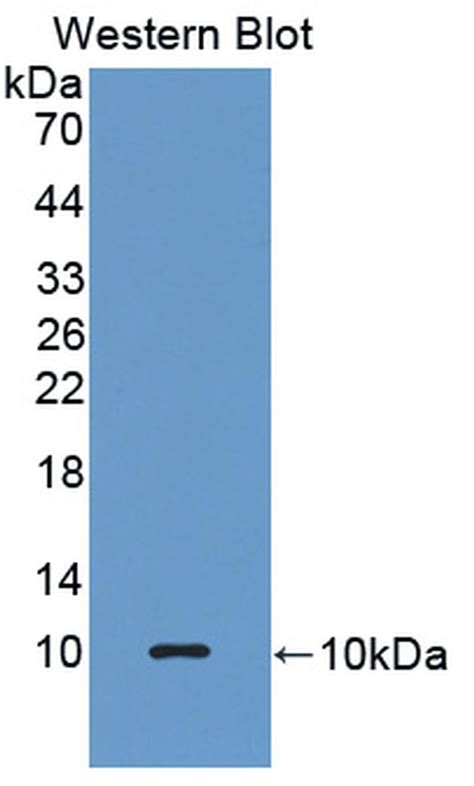 GPX3 Polyclonal Antibody (PA5-119141)