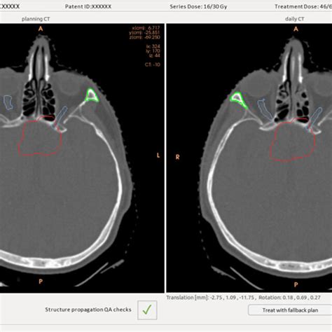 Example Of The Structure Propagation Check User Interface In Adapt Download Scientific Diagram