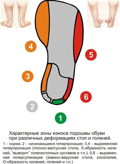 Клуб выпускников МГУ: ПРОНАЦИЯ - важно для ног!