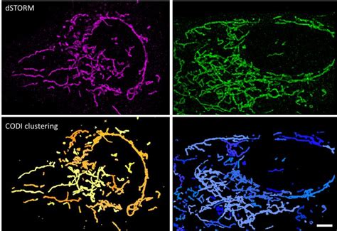 Oni On Linkedin Fluorescencefriday Microscopy Superresolution
