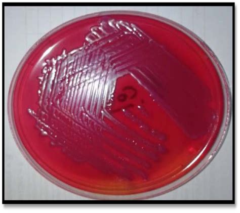 Xld Agar E Coli