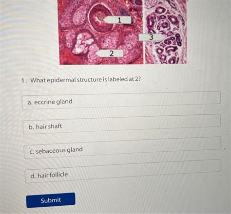 Solved 1 What Epidermal Structure Is Labeled At 2
