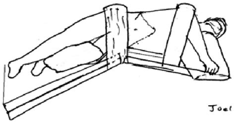 Patient Position For Donor Nephrectomy An Incision Is Made In Line With