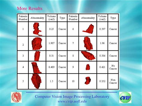 Ppt Detection Visualization And Identification Of Lung Abnormalities In Chest Spiral Ct