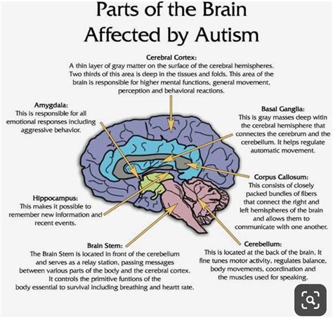 Aspergers Autism Adhd And Autism Autism Help Speech Language Therapy Speech Therapy Sensory