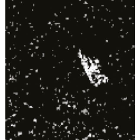 Image Comparison Before And After Markov Random Field Correction A