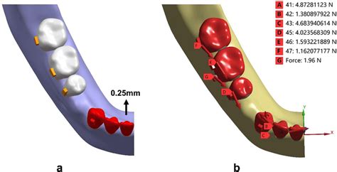 Loading Method To Simulate Anterior En Masse Retraction A The Download Scientific Diagram