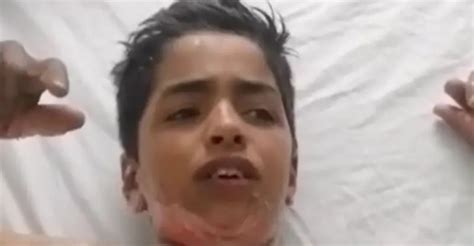 طلاب يحرقون زميلهم داخل مدرسة بالأردن أشعلوا النار فيه بعد سكب الكاز