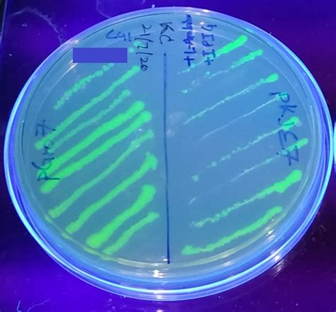 Why Recombinant Expression Of Gfp In Pichia Pastoris Yeast Cannot Be